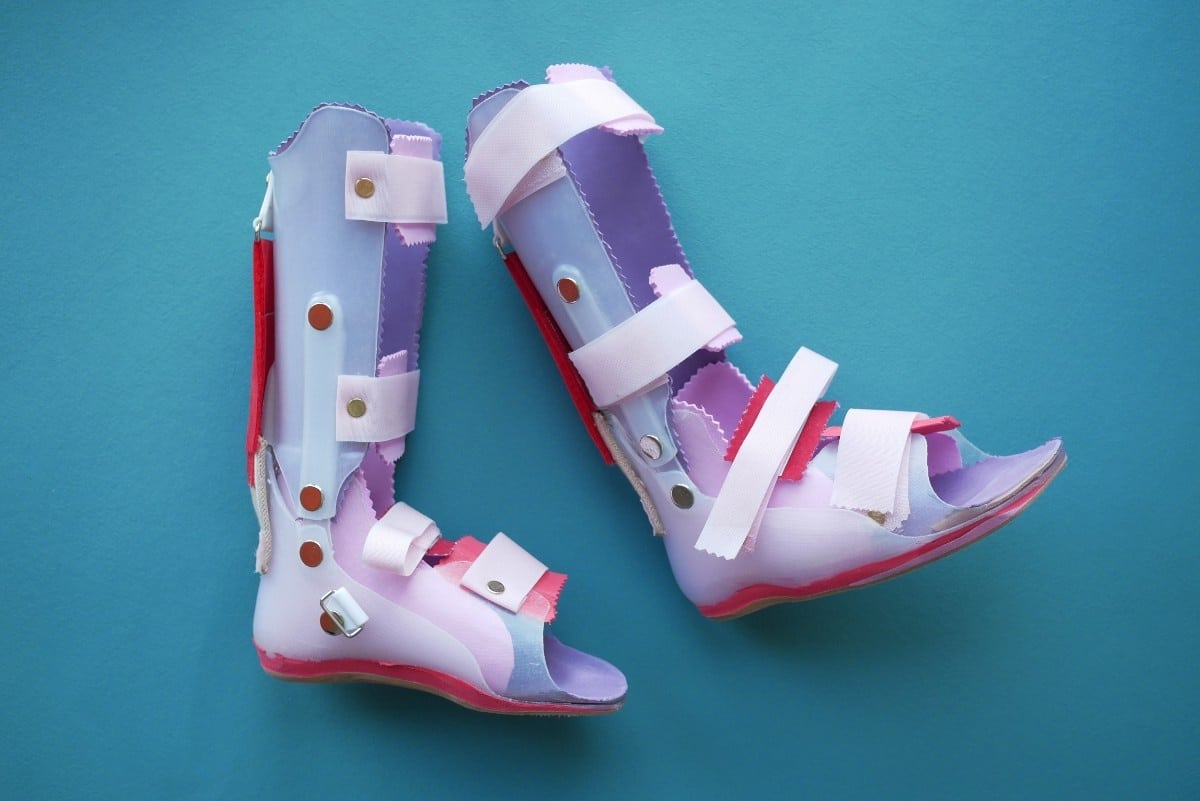 Pediatric SMO Orthotics: Effectiveness & How They Work – The Butterfly Pig